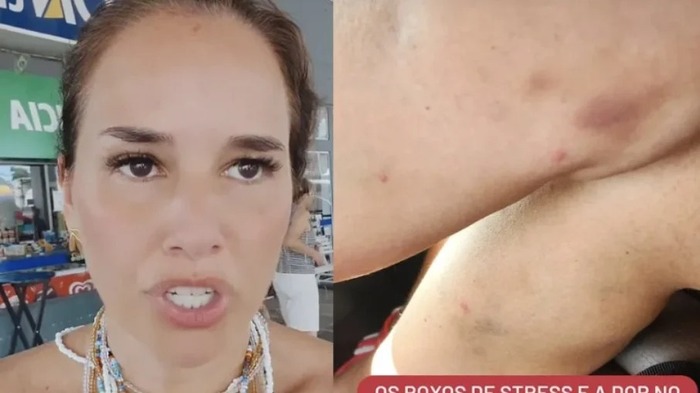 Filha da cantora Fafá de Belém mostra roxos e desabafa após passar por ...